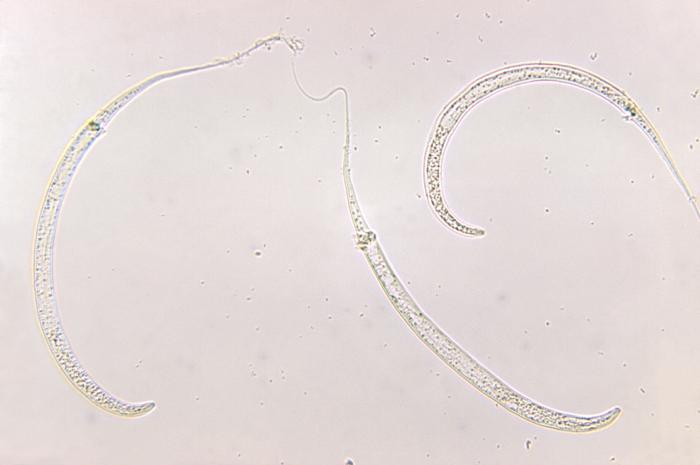 Guinea worm: A nasty parasite is nearly eradicated, but the push for ...